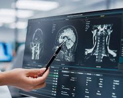 Neuroimaging – Lamb Technologies