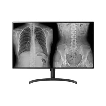 LG 8MP Color Diagnostic Monitor – Lamb Technologies