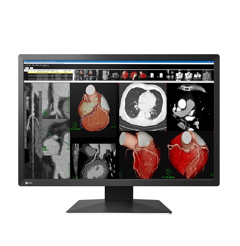 Eizo Radiforce MX243W – Lamb Technologies