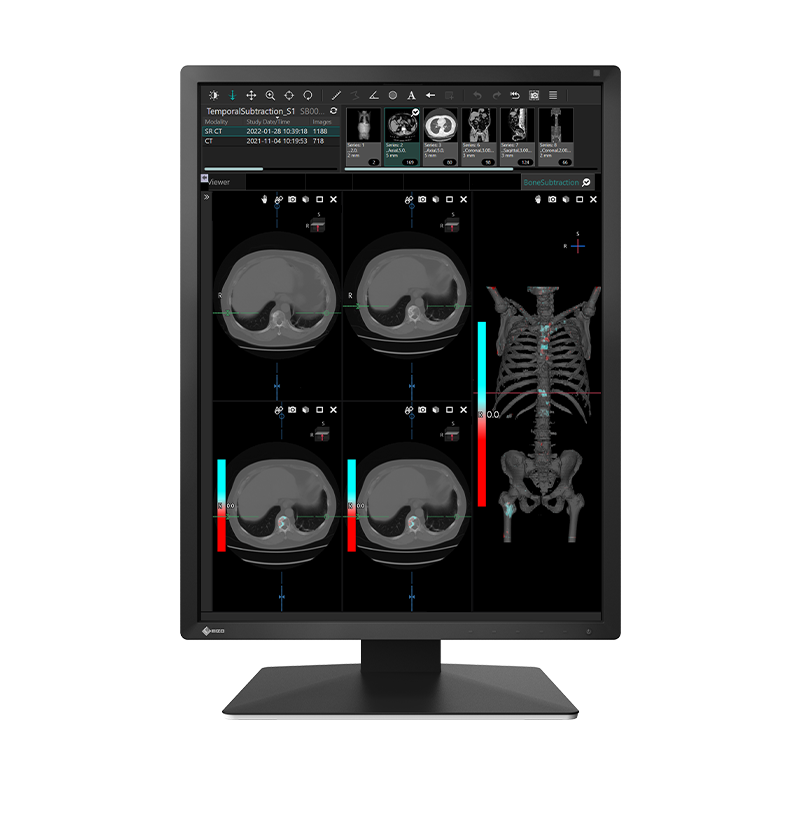 Eizo Radiforce MX217 – Lamb Technologies